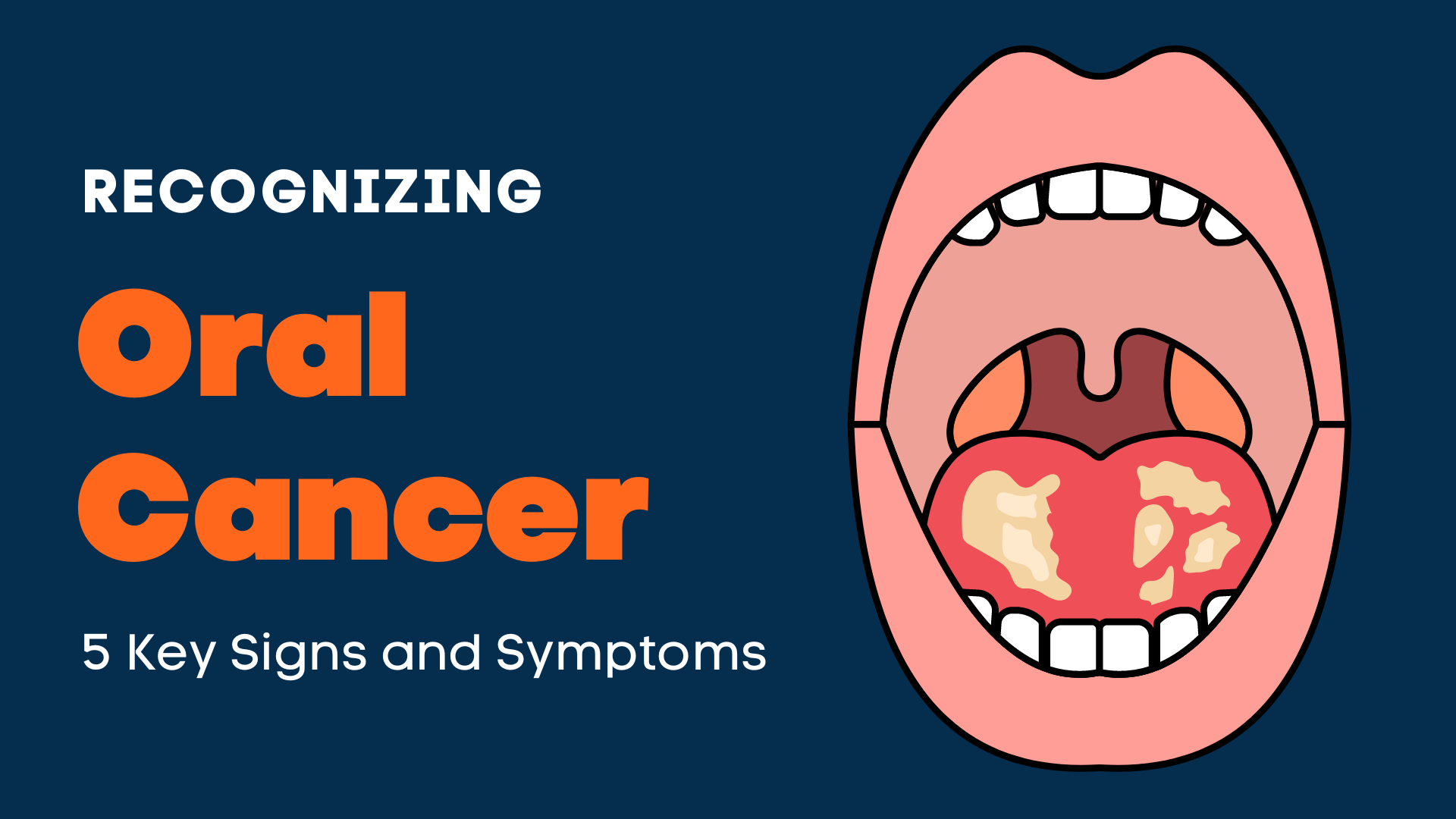 Recognizing Oral Cancer: 5 Key Signs and Symptoms to Watch For - Dental ...